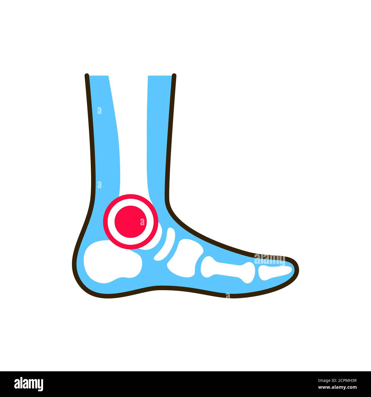 Ankle arthritis line color icon. Inflammation joint. Sign for web page ...