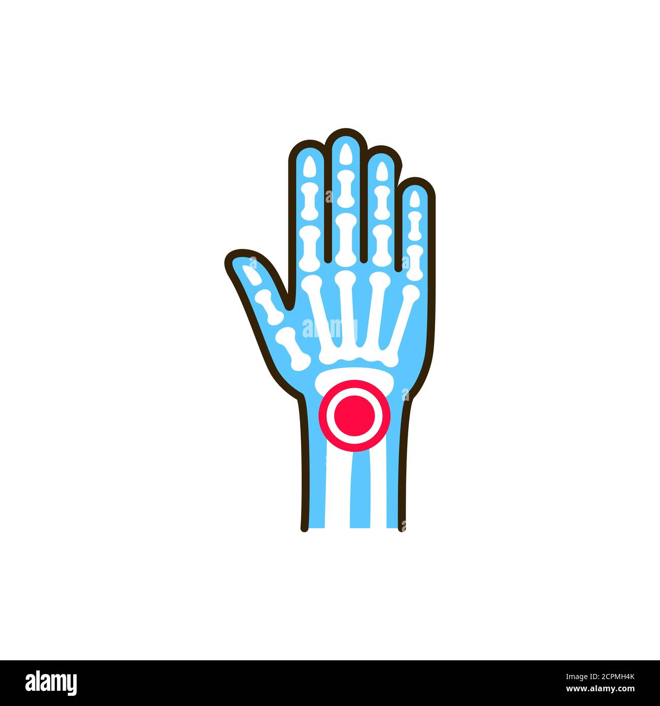 Arthritis wrist line color icon. Inflammation joint. Sign for web page ...