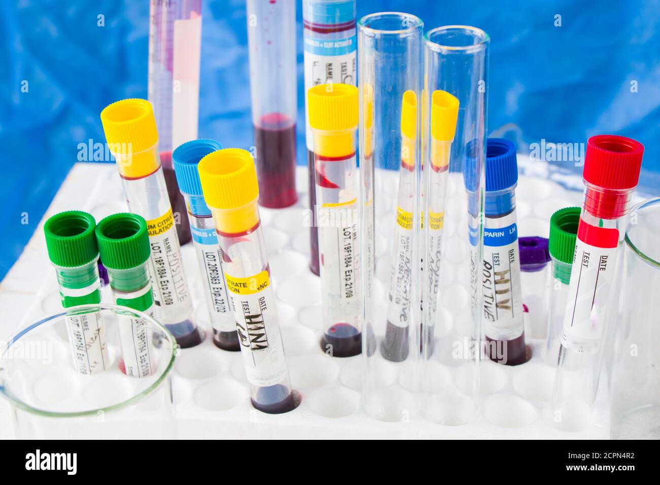 Laboratory table, blood test tube samples and glassware with liquid ...