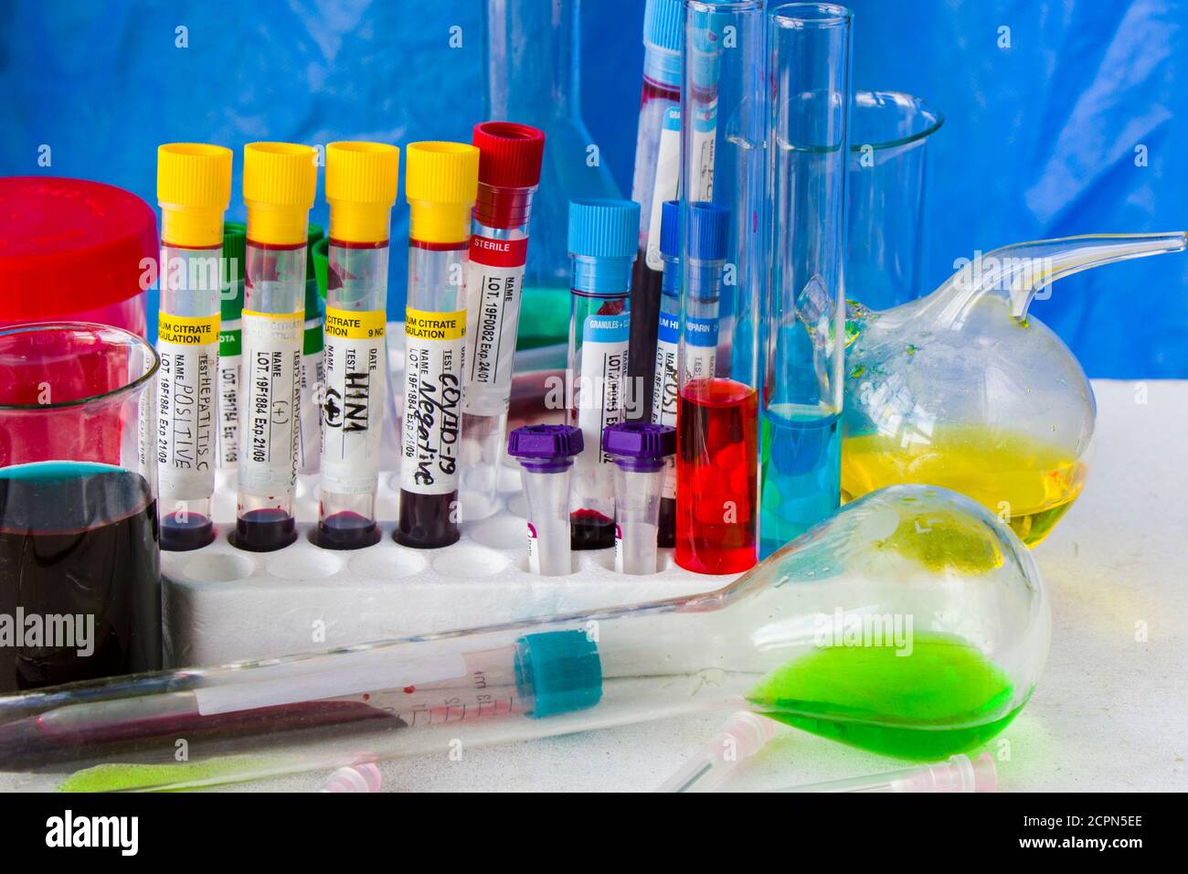 Laboratory table, blood test tube samples and glassware with liquid ...