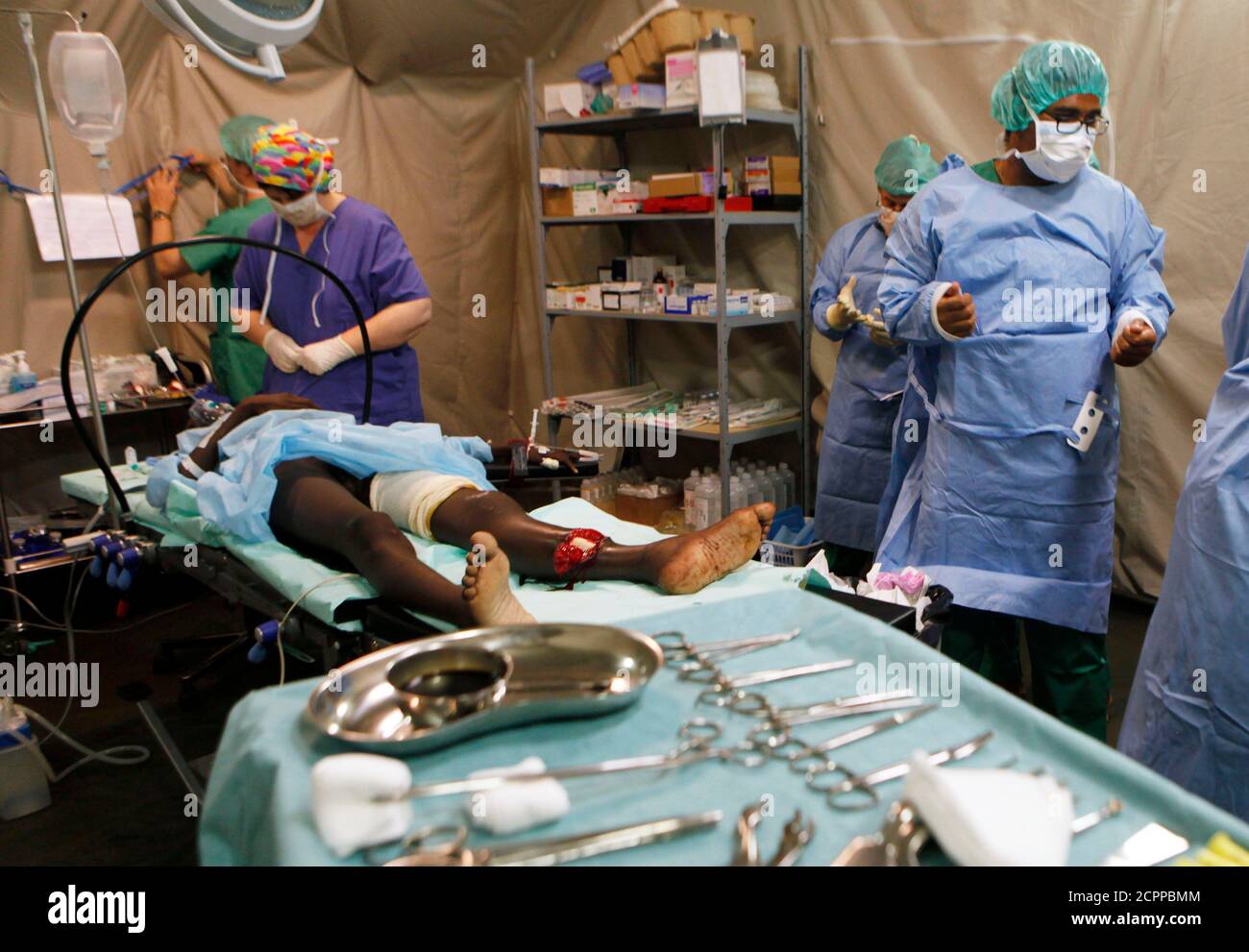 Compound fracture hi-res stock photography and images - Alamy