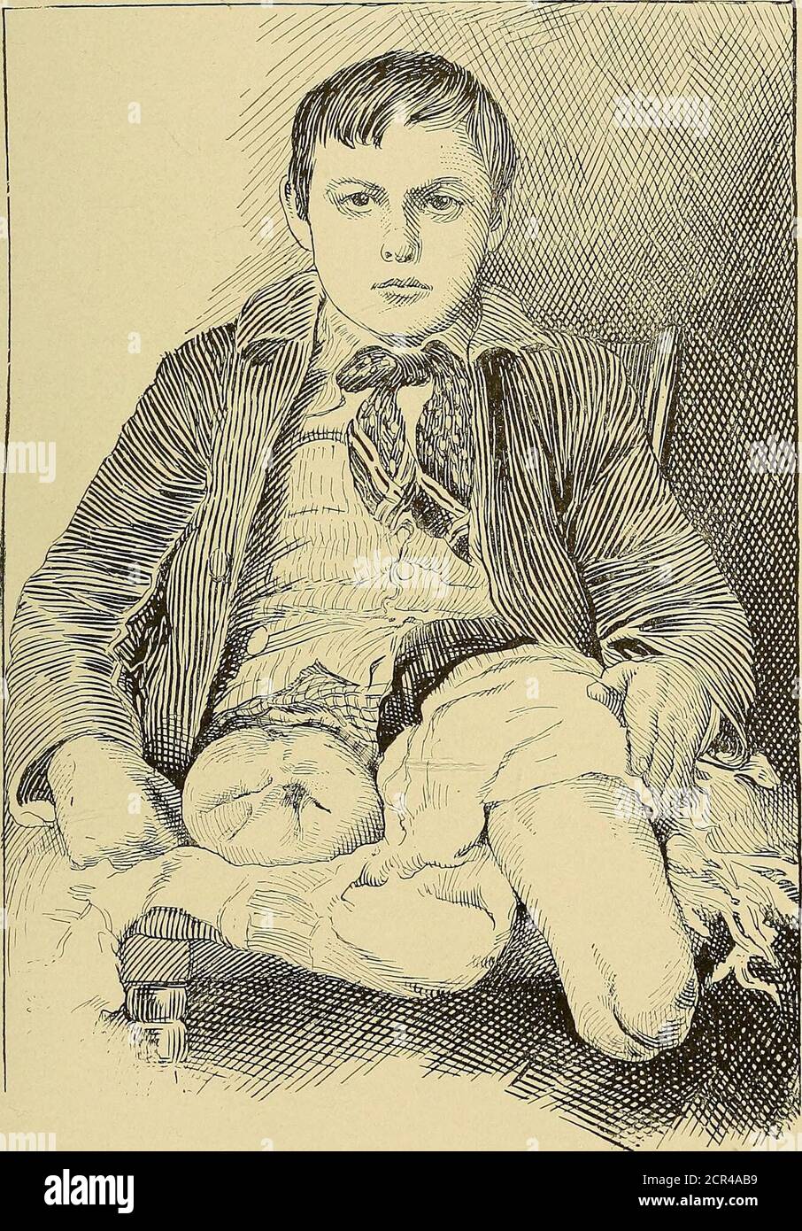 . Railway surgery : a handbook on the management of injuries . FlG. 77 ...