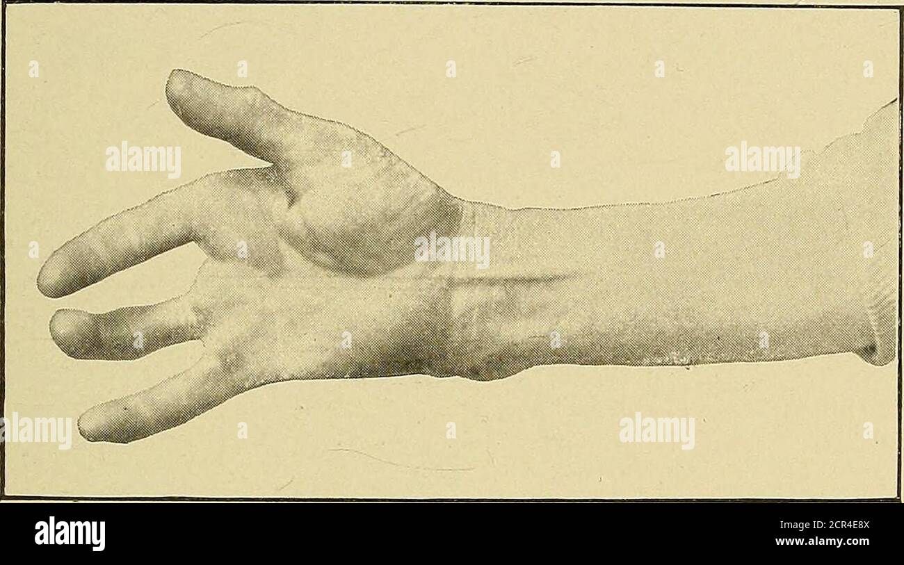 . Railway surgery : a handbook on the management of injuries . ors and ...