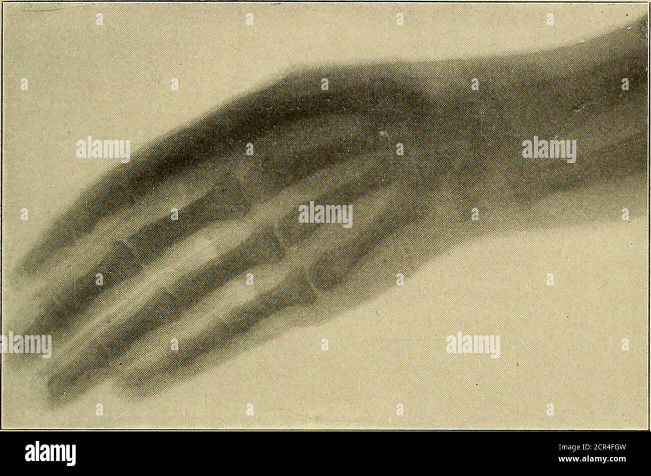 . Railway surgery : a handbook on the management of injuries . of the ...