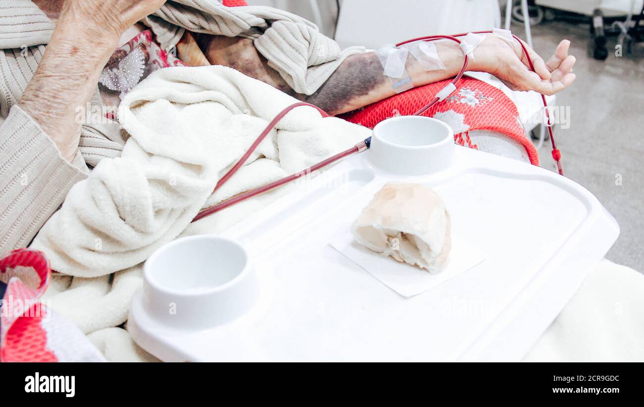 hemodialysis in people on the equipment Stock Photo - Alamy
