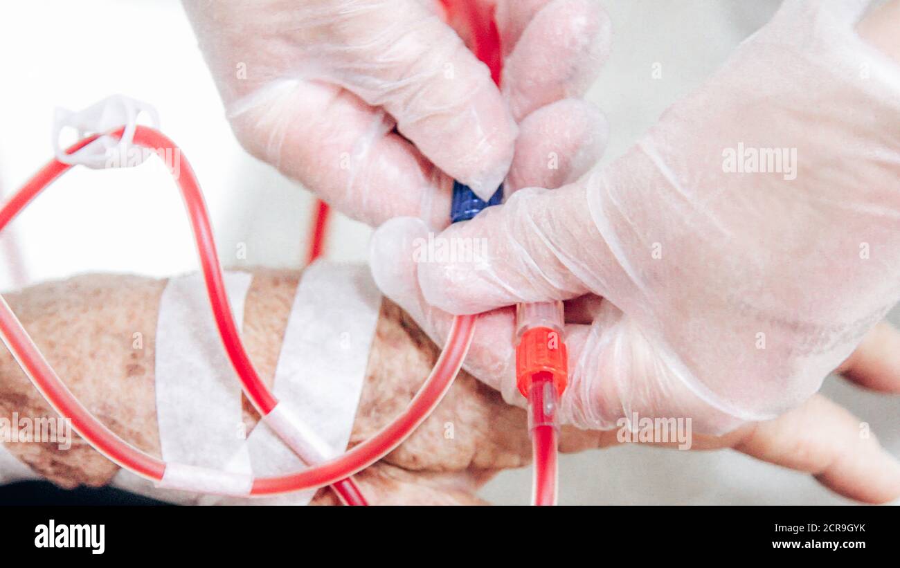 hemodialysis in people on the equipment Stock Photo - Alamy
