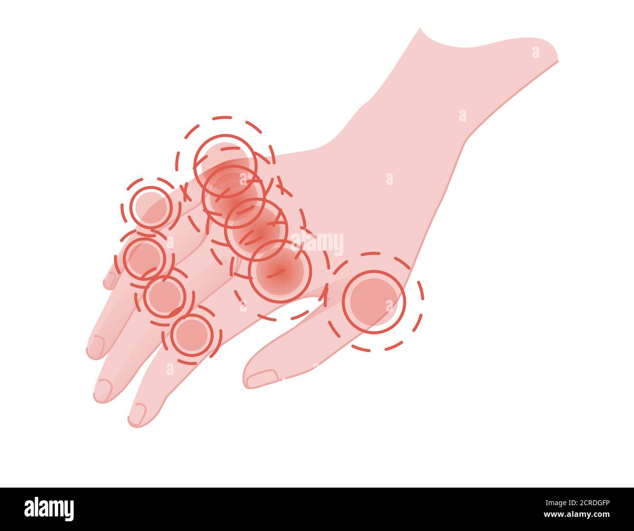 Human pain in the fingers with red pain circle flat vector illustration ...