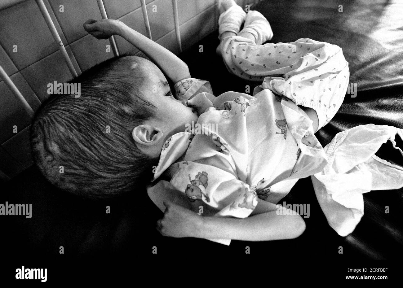 Deformed head hi-res stock photography and images - Alamy