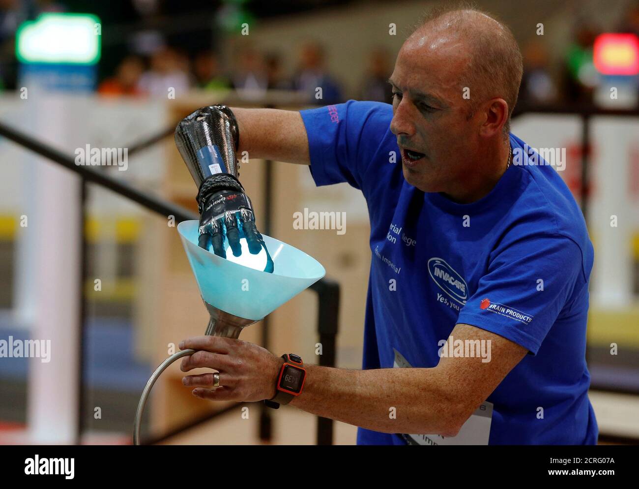 Arm prosthesis hi-res stock photography and images - Alamy