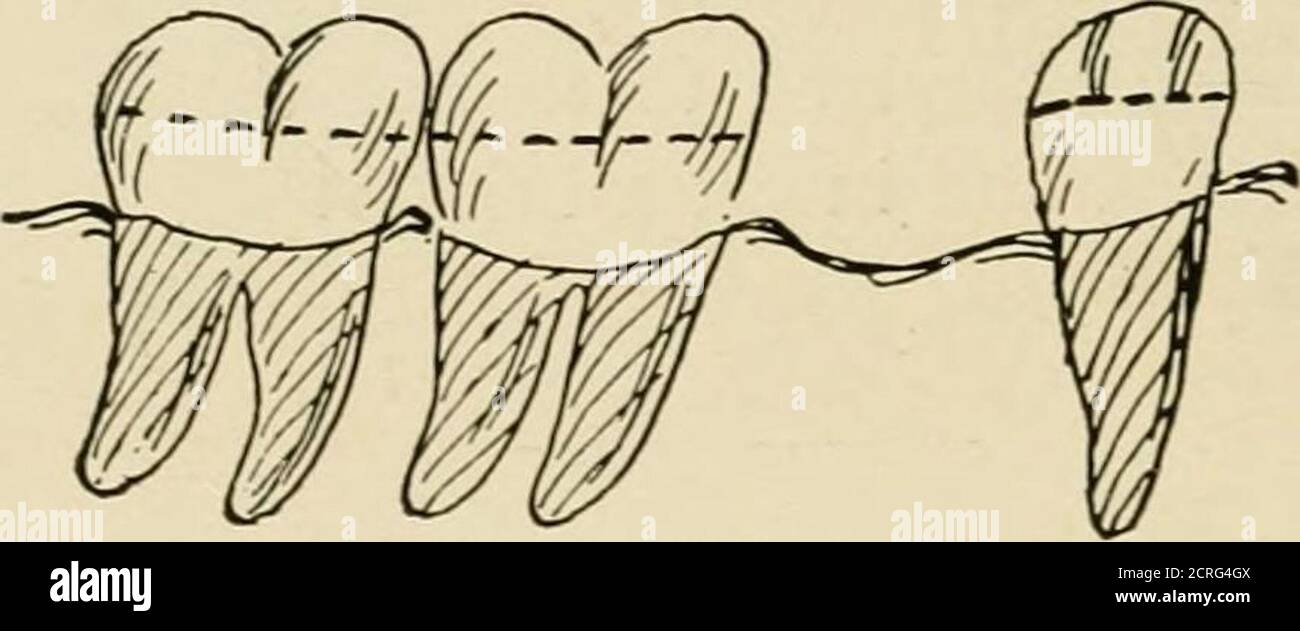 . Elementary and dental radiography / by Howard Riley Raper . the ...