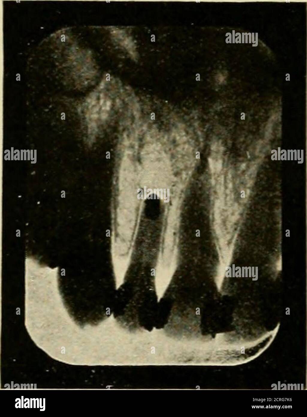 . Elementary and dental radiography / by Howard Riley Raper . Fig. 490A ...