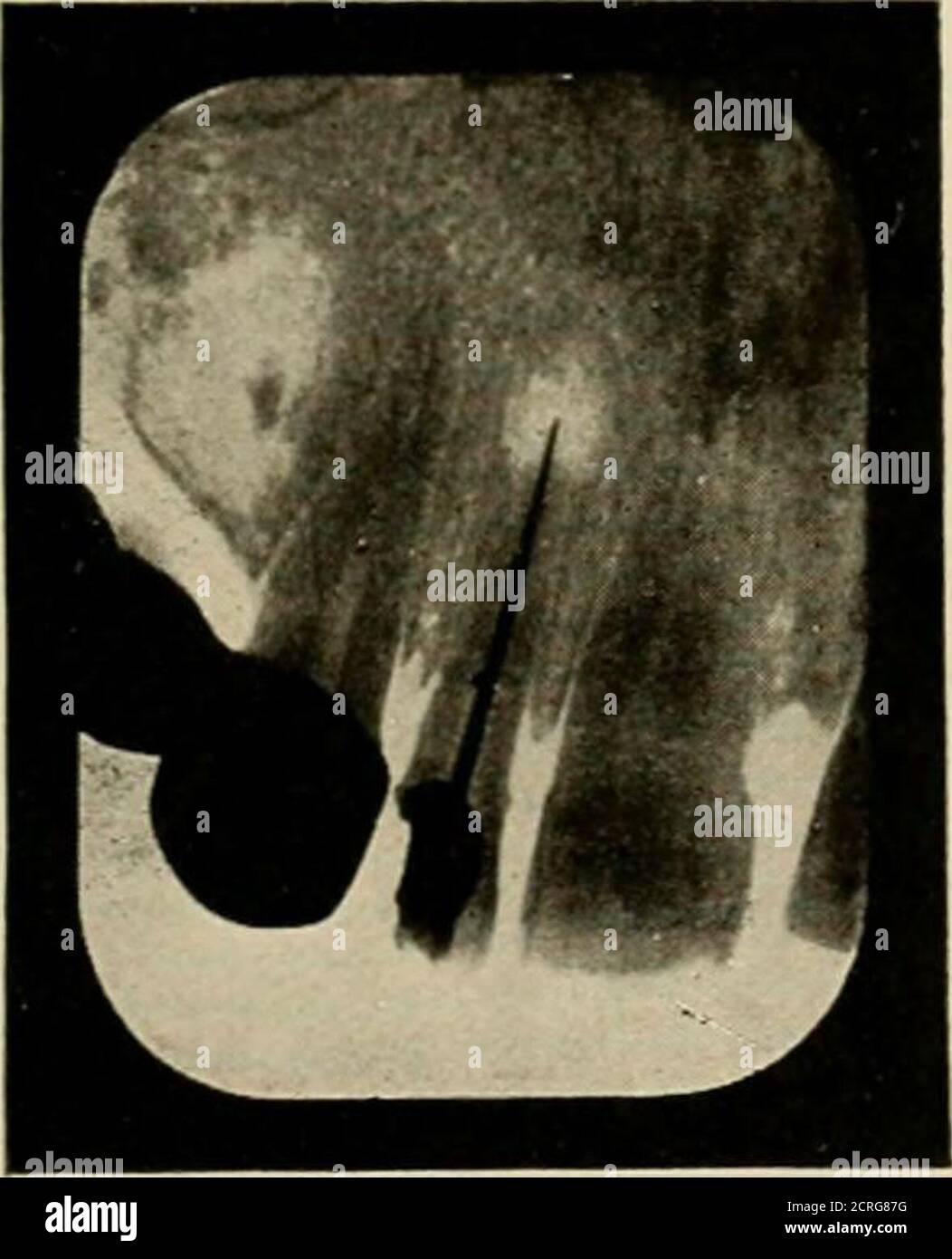 . Elementary and dental radiography / by Howard Riley Raper . Fig. 494A ...