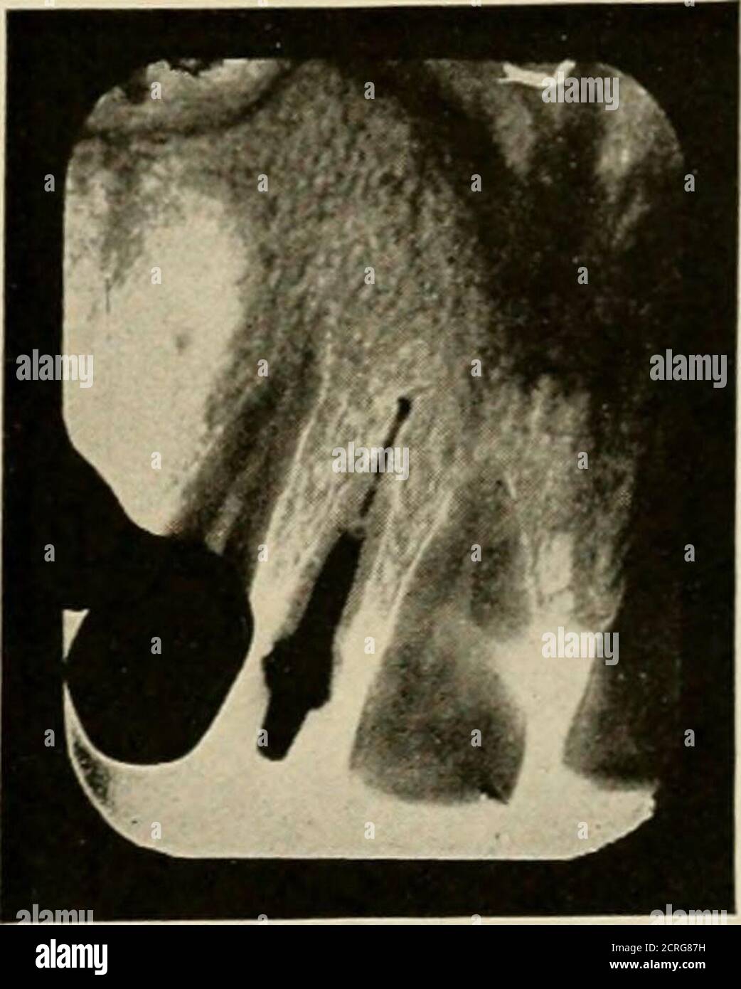 . Elementary and dental radiography / by Howard Riley Raper . Fig. 495A ...