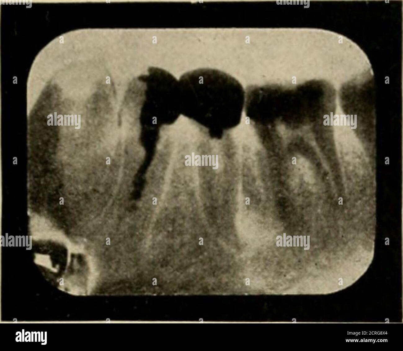 . Elementary and dental radiography / by Howard Riley Raper . Fig. 493A ...