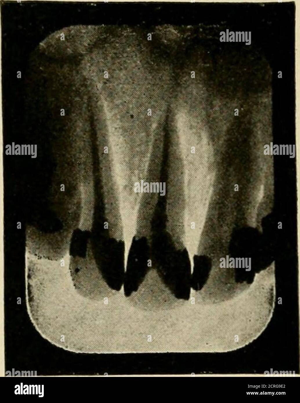 . Elementary and dental radiography / by Howard Riley Raper . Fie 492A ...