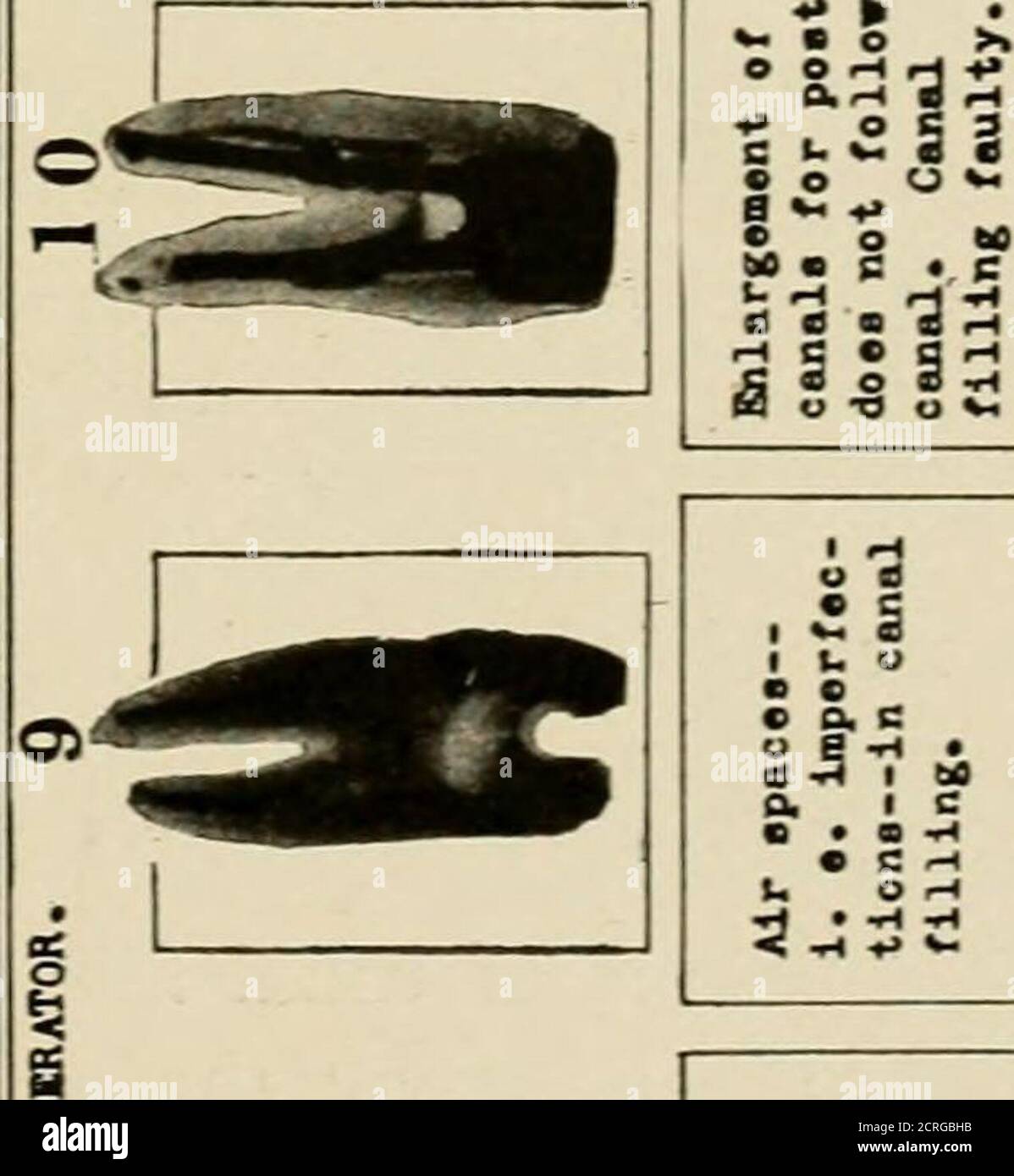 . Elementary and dental radiography / by Howard Riley Raper Stock Photo ...