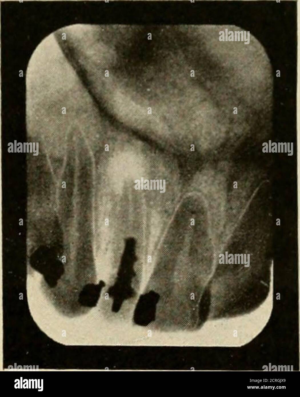 . Elementary and dental radiography / by Howard Riley Raper . Fig. 4 ...