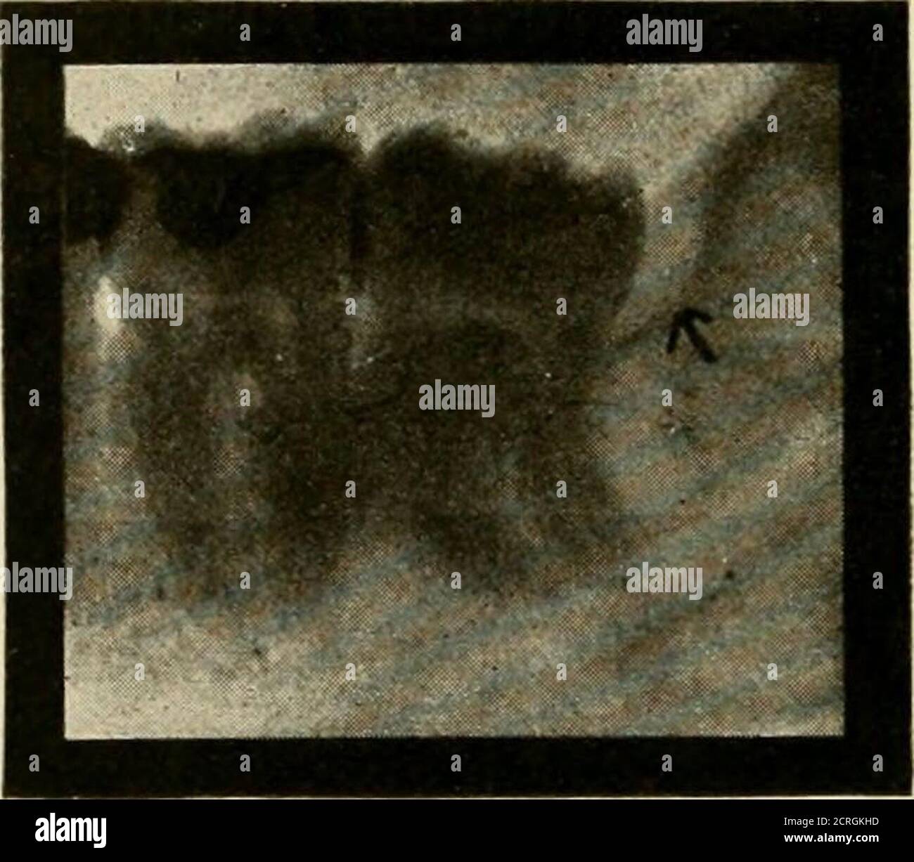 . Elementary and dental radiography / by Howard Riley Raper . g. 457 ...