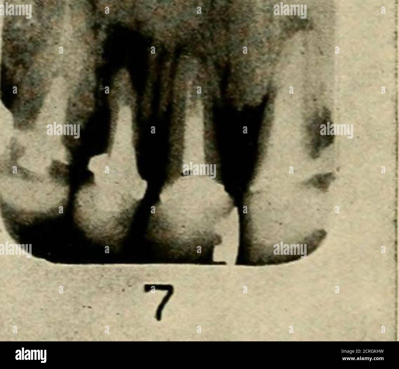 . Elementary and dental radiography / by Howard Riley Raper . J Chart D ...