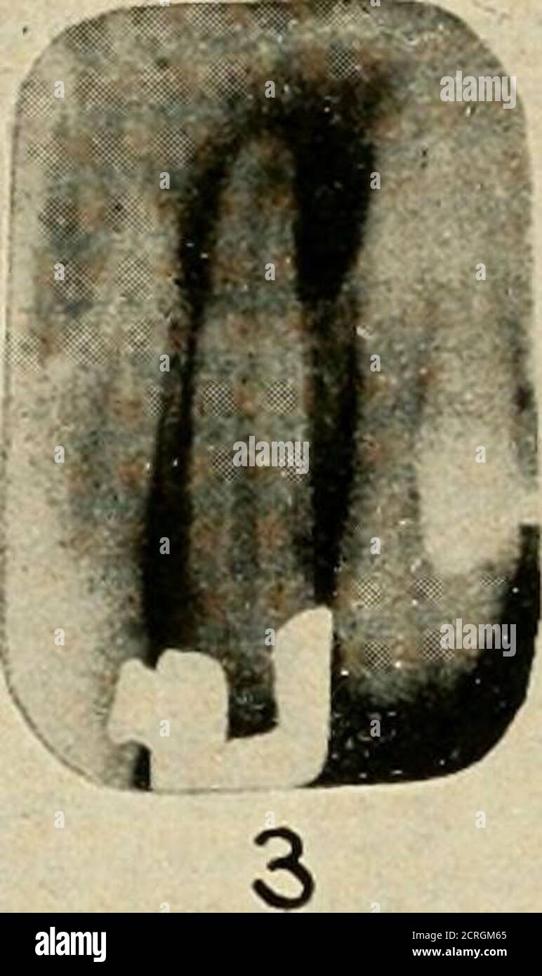 . Elementary and dental radiography / by Howard Riley Raper Stock Photo ...