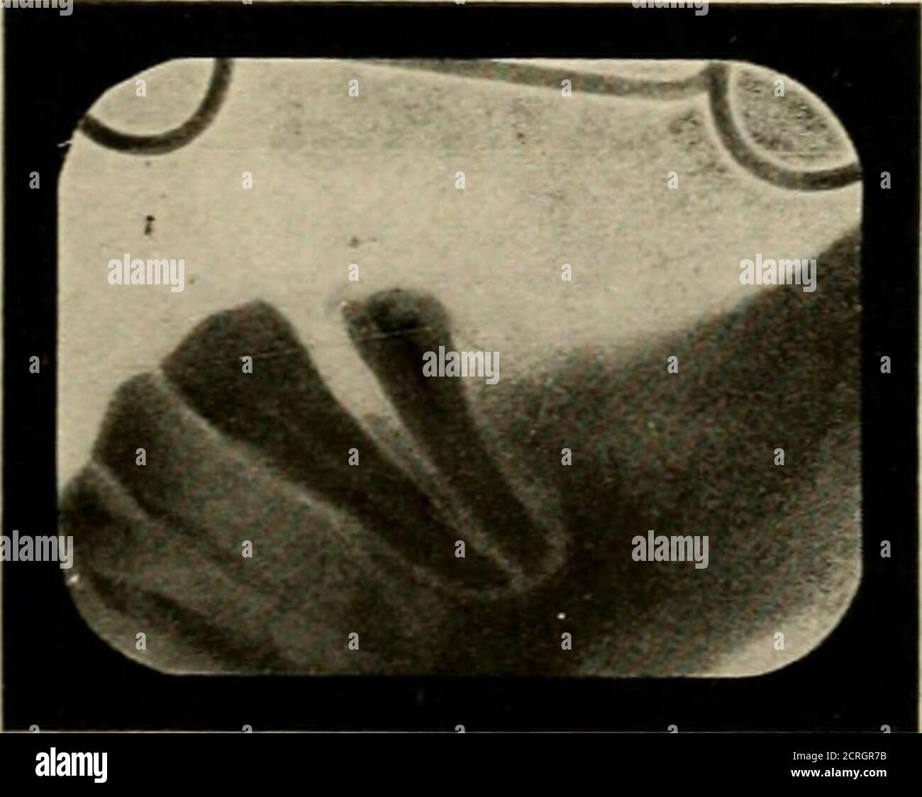 . Elementary and dental radiography / by Howard Riley Raper . Fig. 447A ...