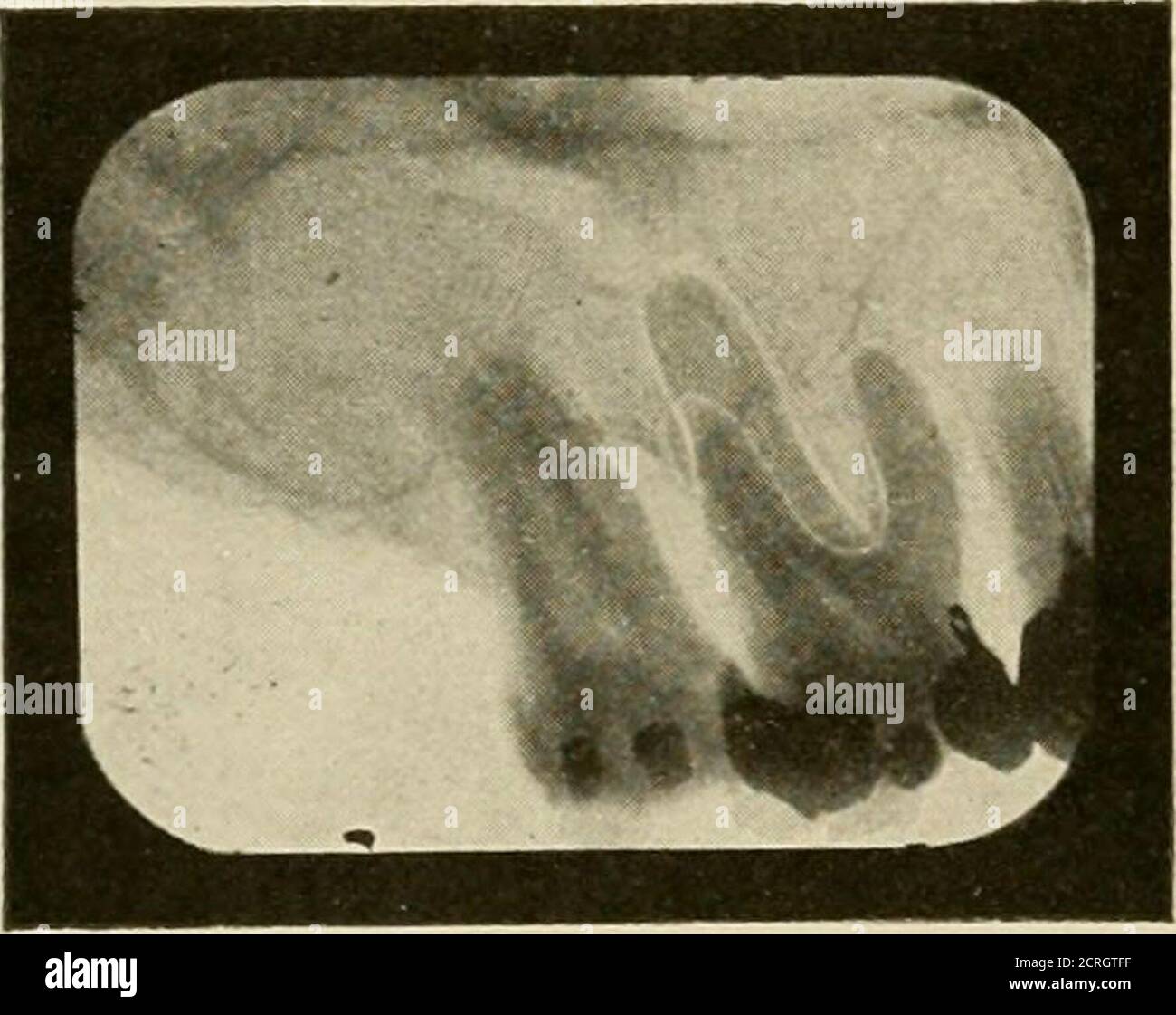 . Elementary and dental radiography / by Howard Riley Raper . Fig. 440 ...