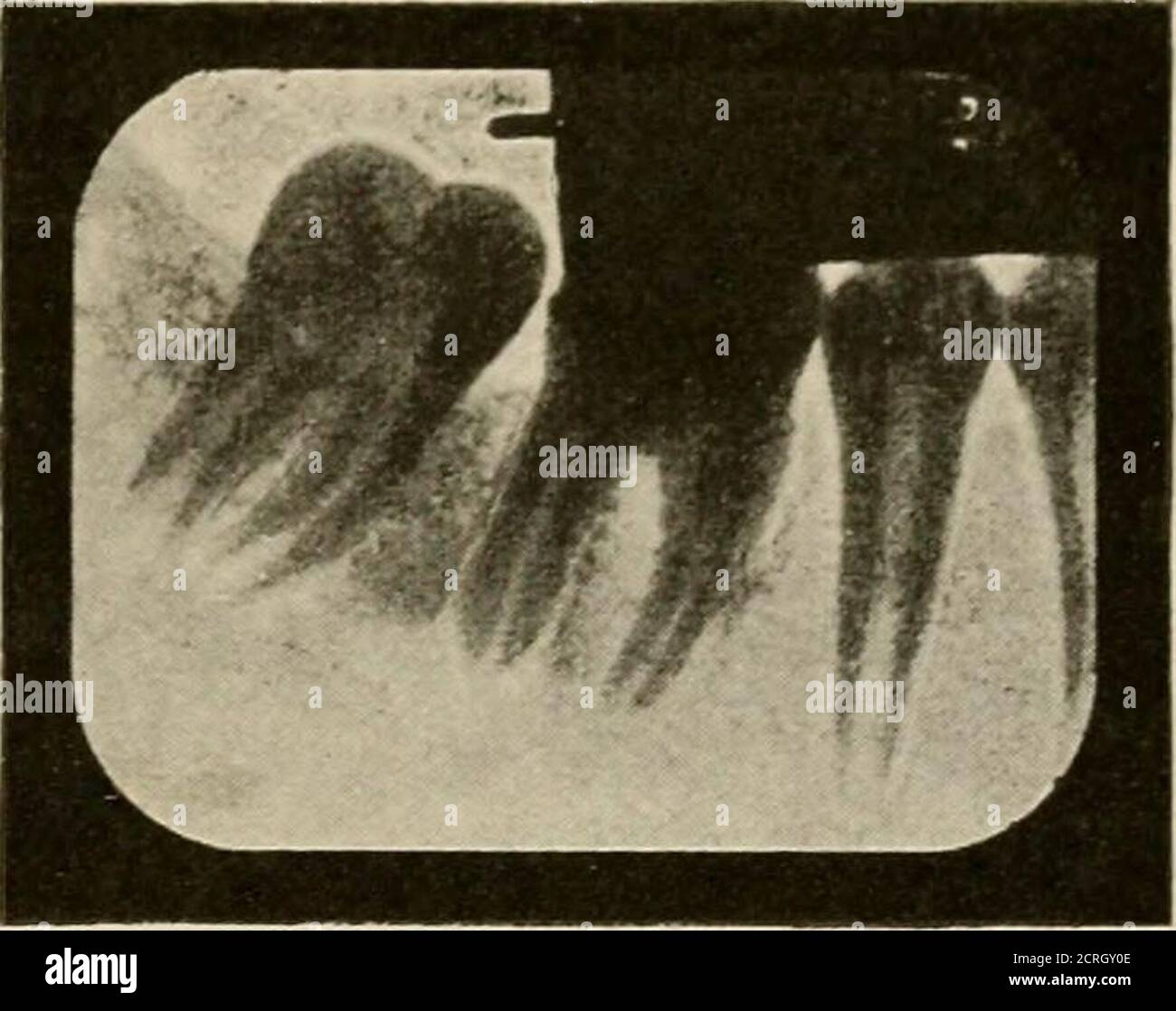 . Elementary and dental radiography / by Howard Riley Raper . Fig. 429 ...