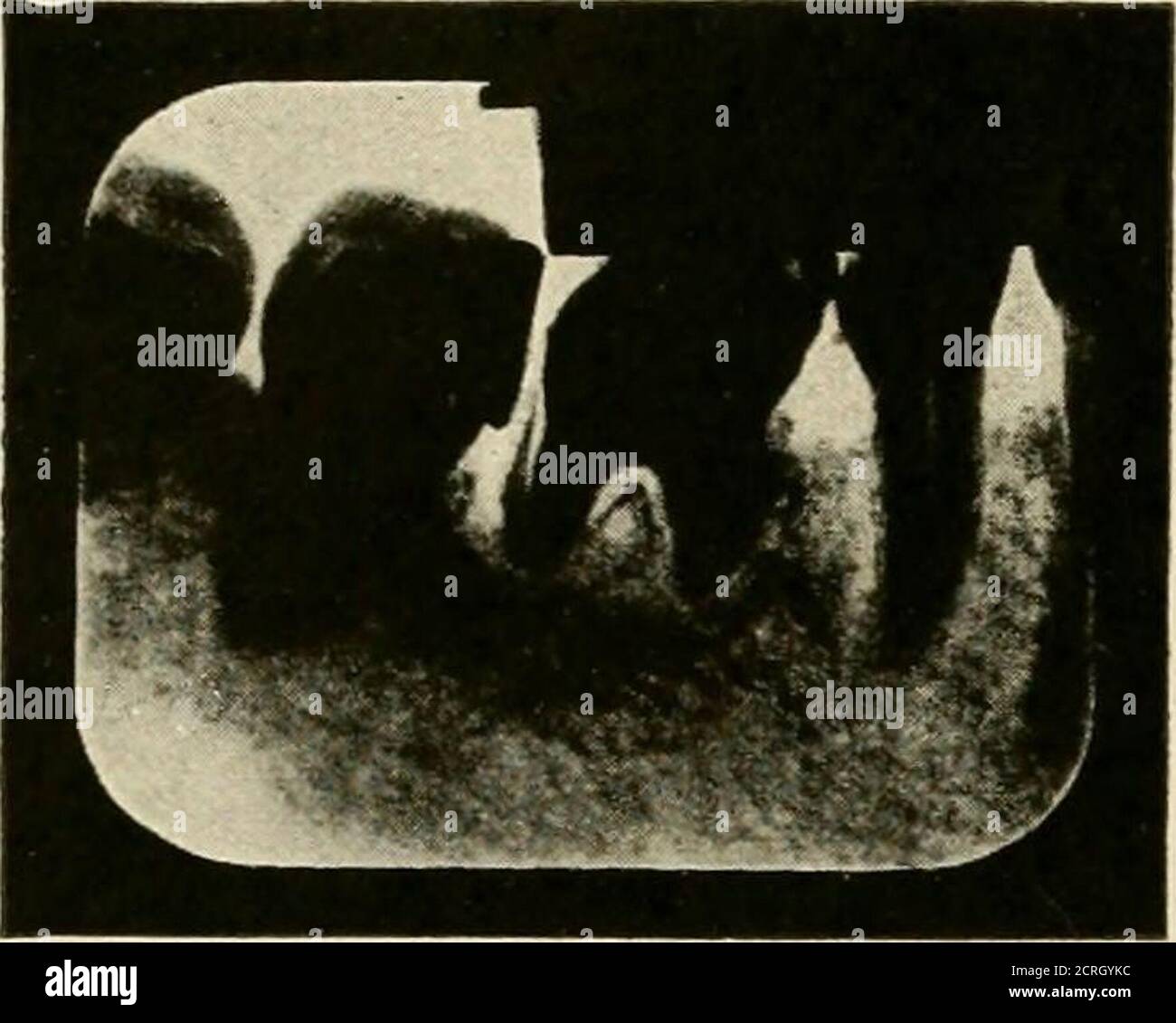 . Elementary and dental radiography / by Howard Riley Raper . der the ...