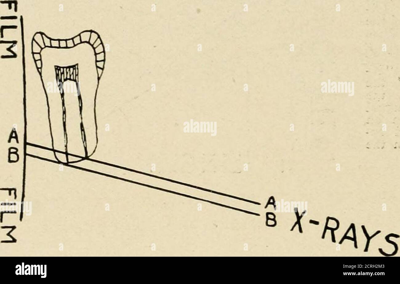 . Elementary and dental radiography / by Howard Riley Raper . ic ...