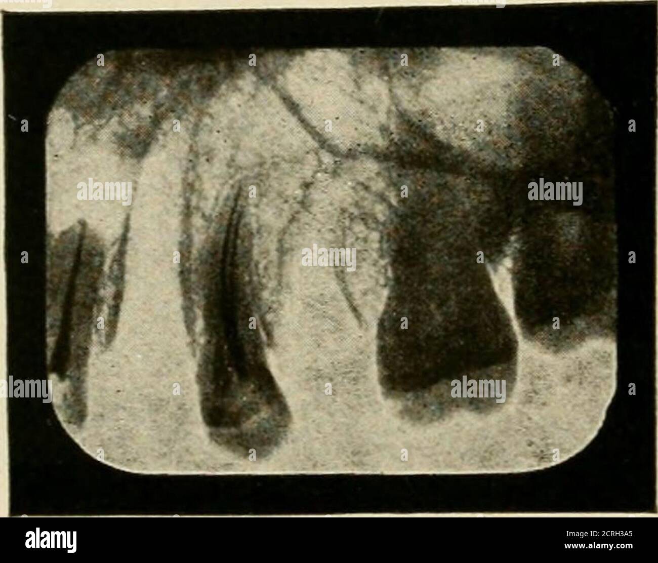 . Elementary and dental radiography / by Howard Riley Raper . Fig. 409 ...