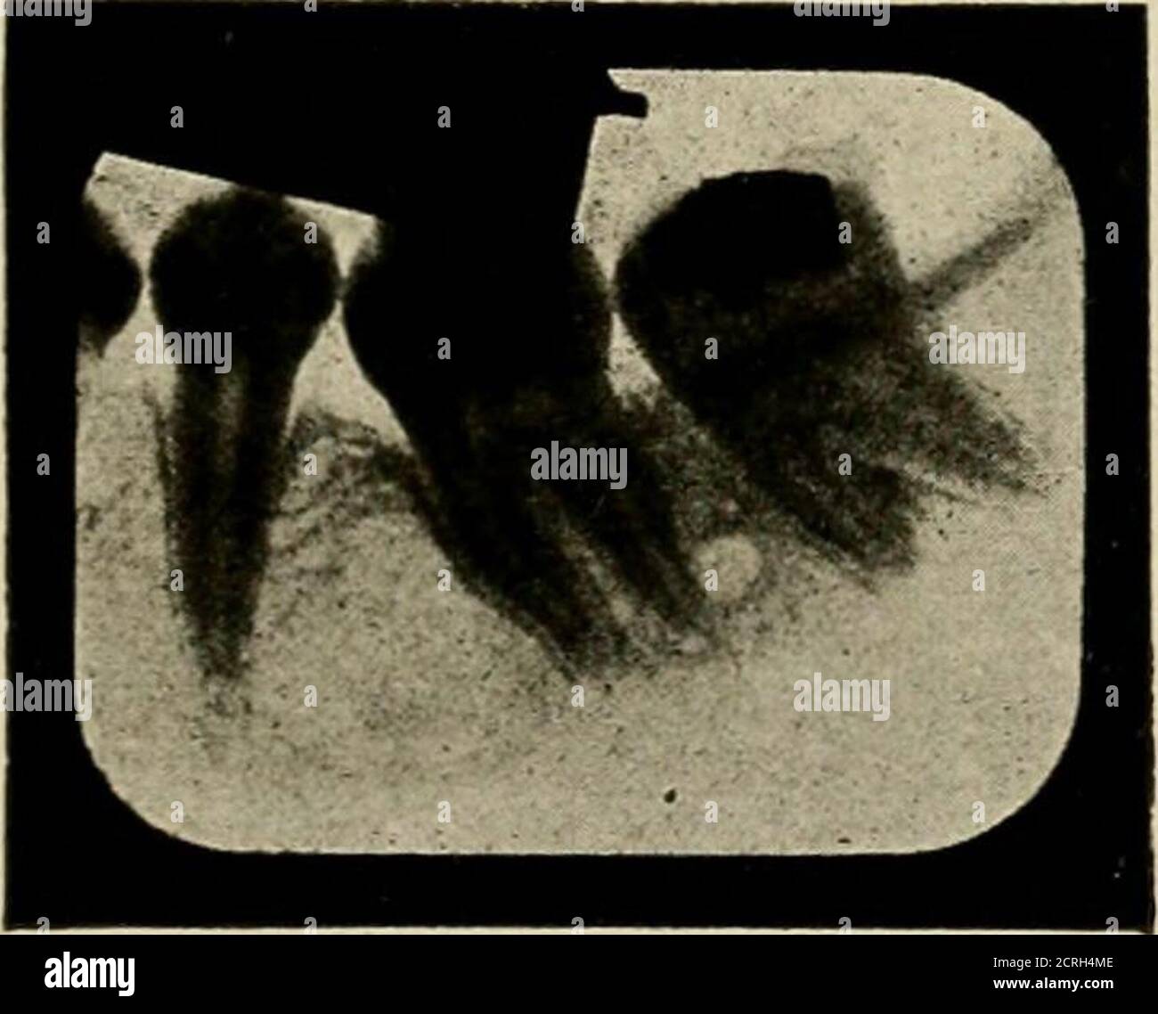 . Elementary and dental radiography / by Howard Riley Raper . Fig. 39U ...