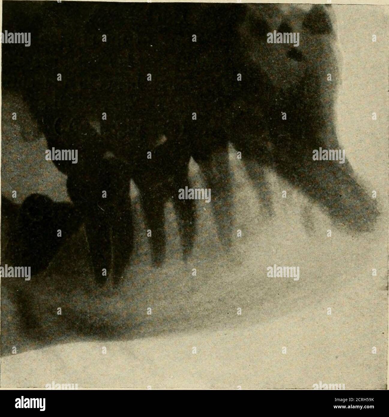 Mandibular third molar hi-res stock photography and images - Alamy Mandibular third molar hi-res stock photography and images - Alamy