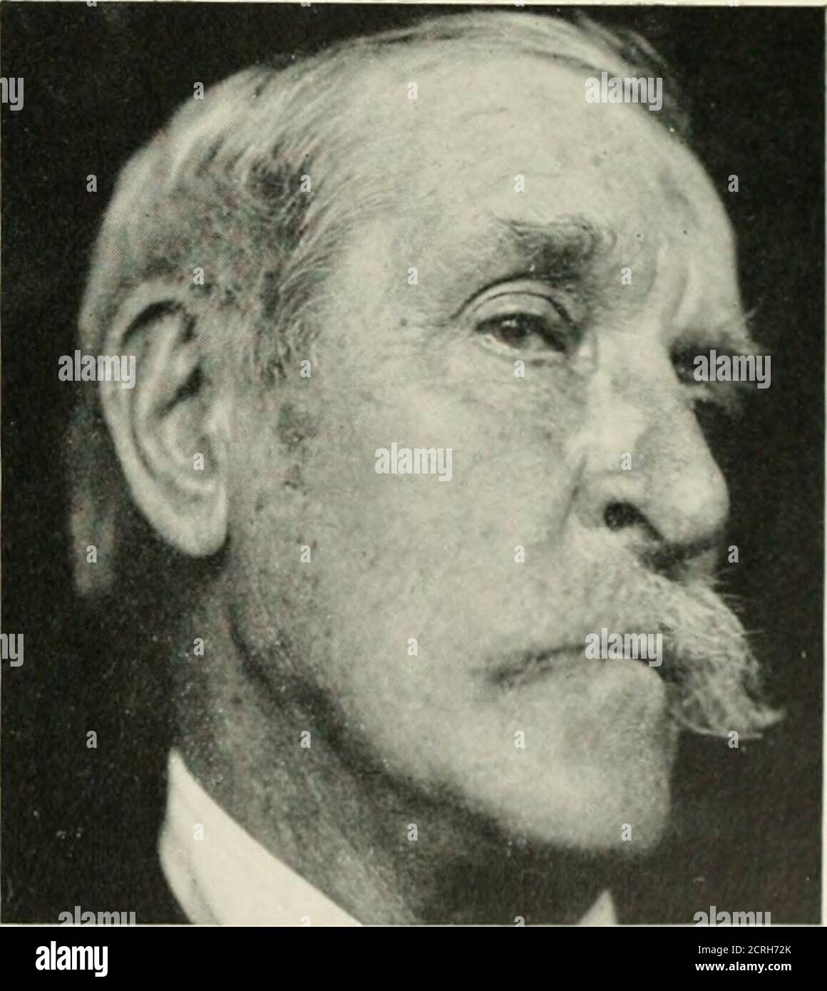 Rodent ulcer nose hi-res stock photography and images - Alamy