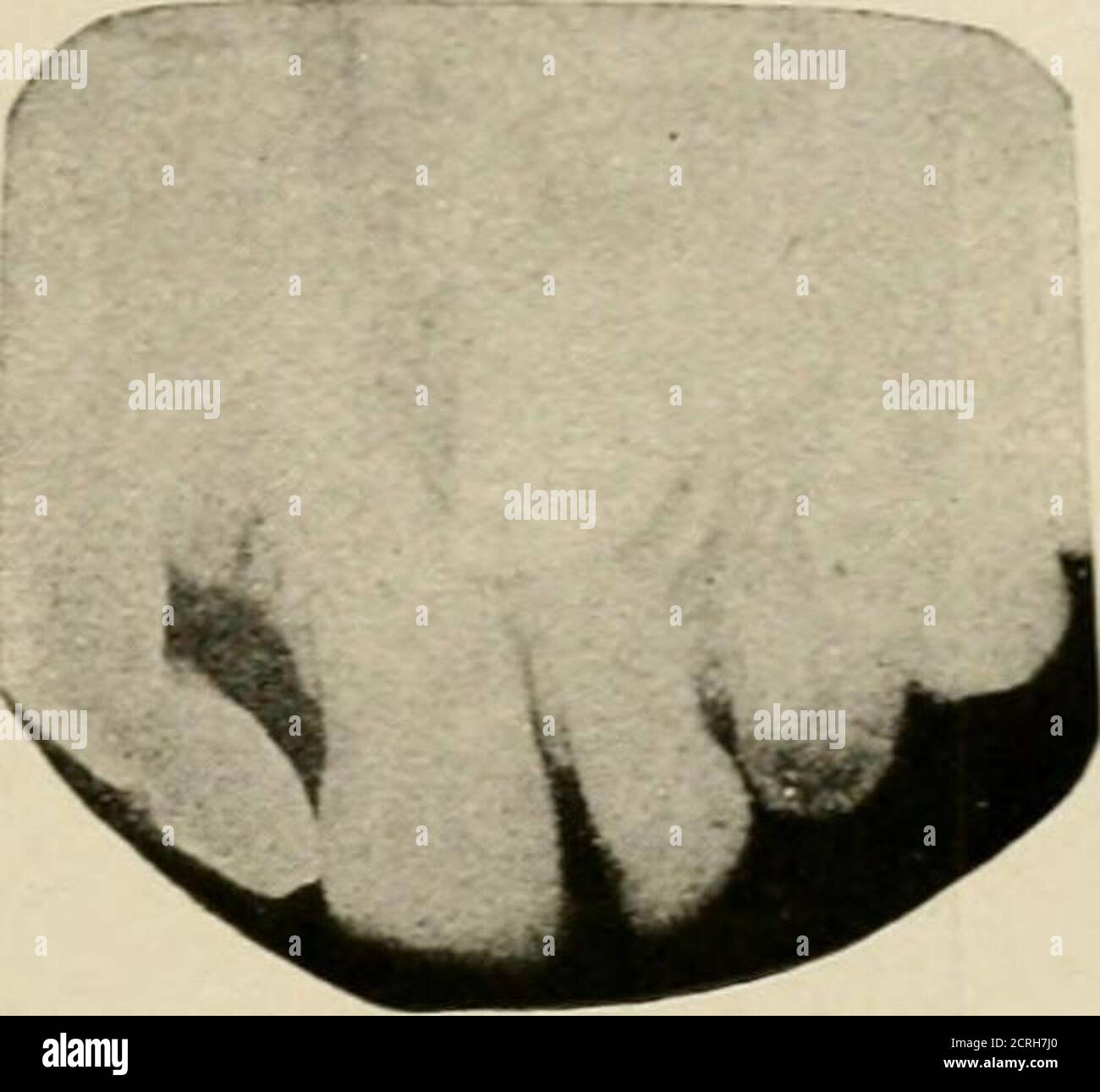 . Elementary and dental radiography / by Howard Riley Raper . Fig. 386 ...