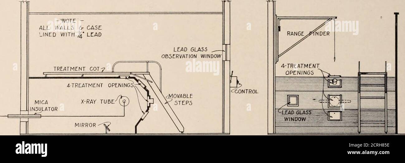 . Journal of radiology . -section- TYPE B CASE - elevation -. -section ...
