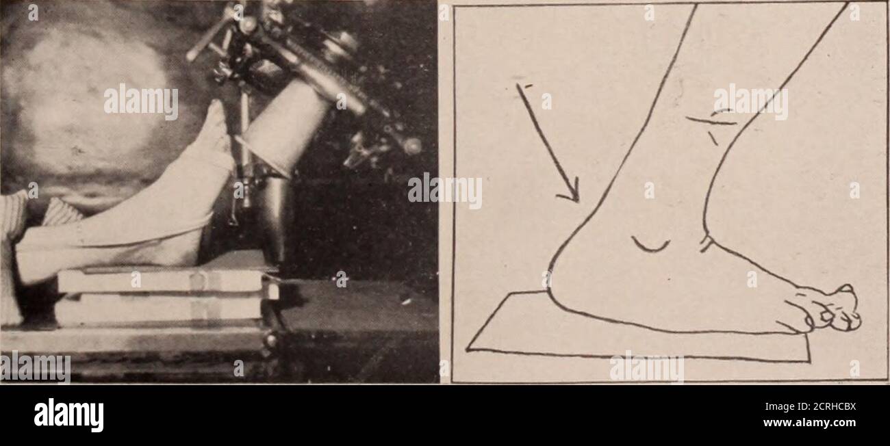 Armyx hi-res stock photography and images - Alamy