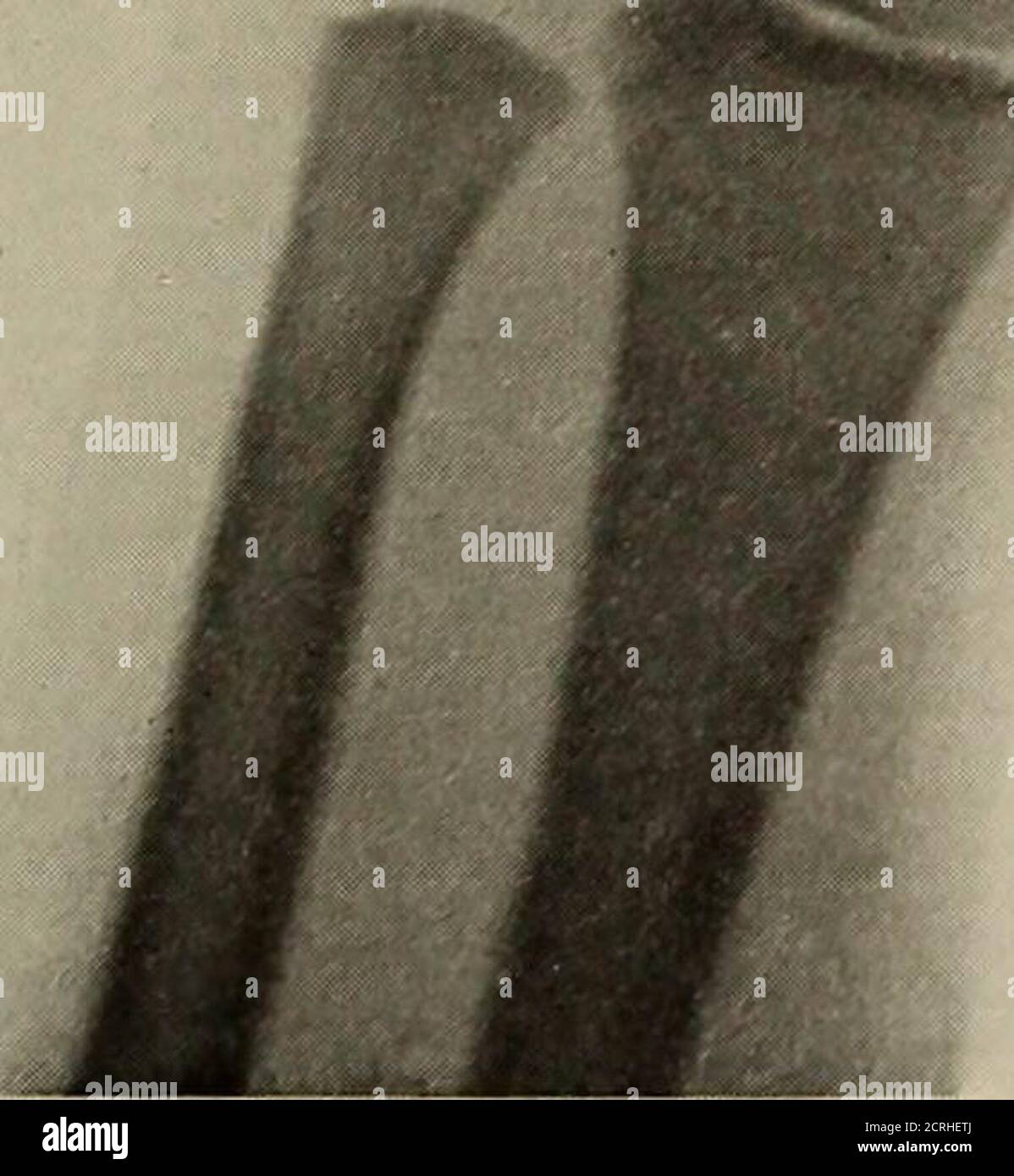 . Living anatomy and pathology Stock Photo - Alamy