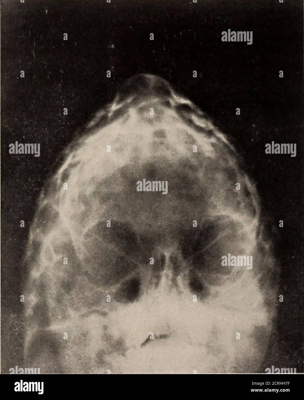 Frontal projection hi-res stock photography and images - Alamy