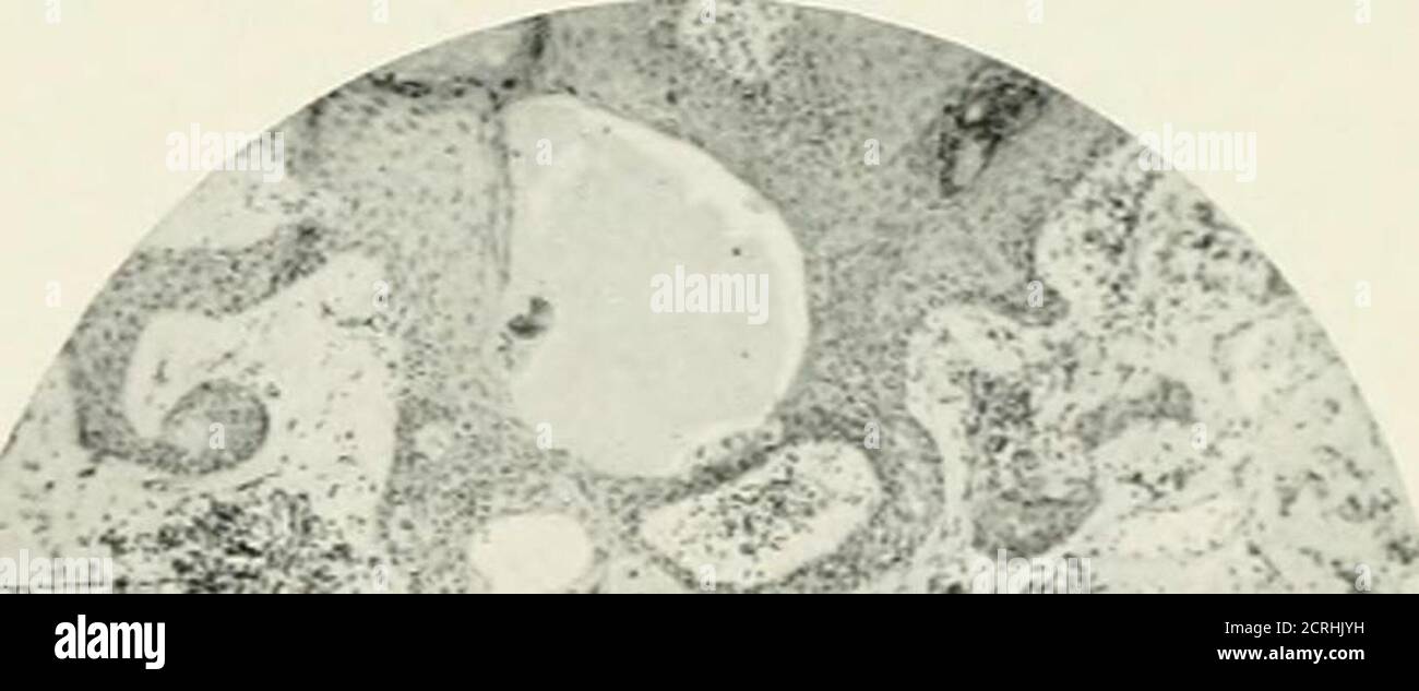 . Radiography, X-ray therapeutics and radium therapy . - ; ••• if. .4 V ...