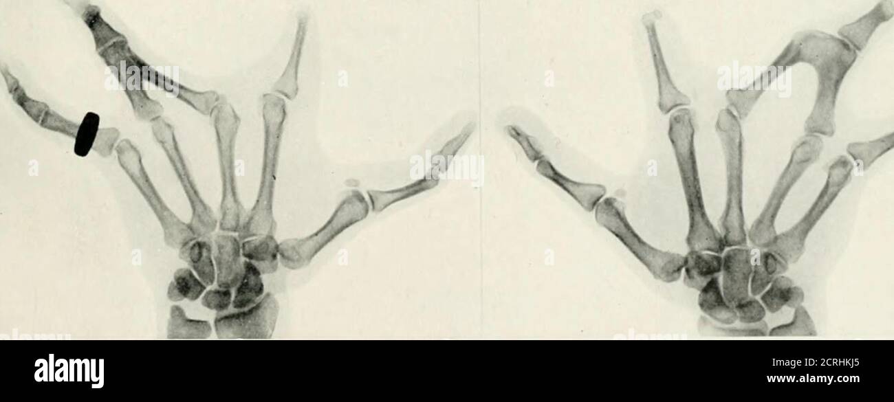 . Radiography, X-ray therapeutics and radium therapy . PLATE LIV ...
