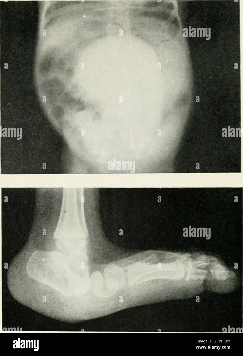 . Radiography, X-ray therapeutics and radium therapy Stock Photo - Alamy