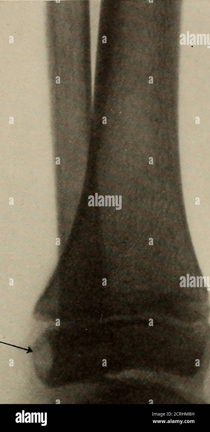 . Living anatomy and pathology; . PLATE 230. UNDETERMINED INFECTION OF ...