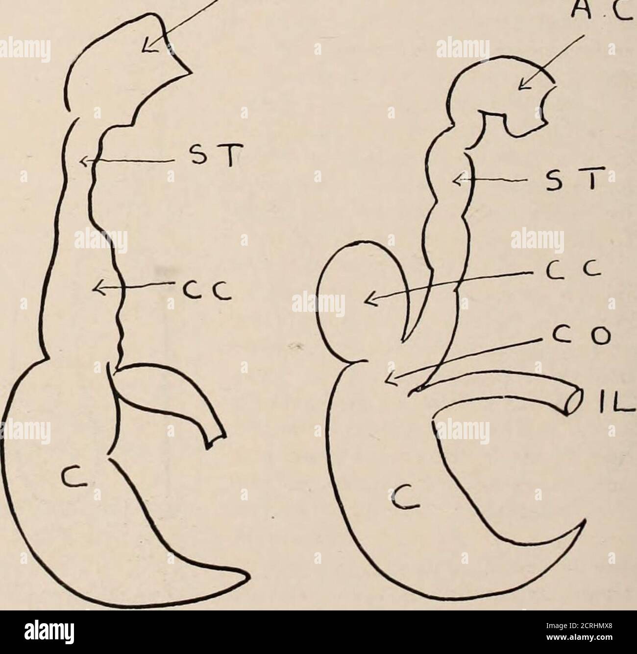 Ileocecal hi-res stock photography and images - Alamy