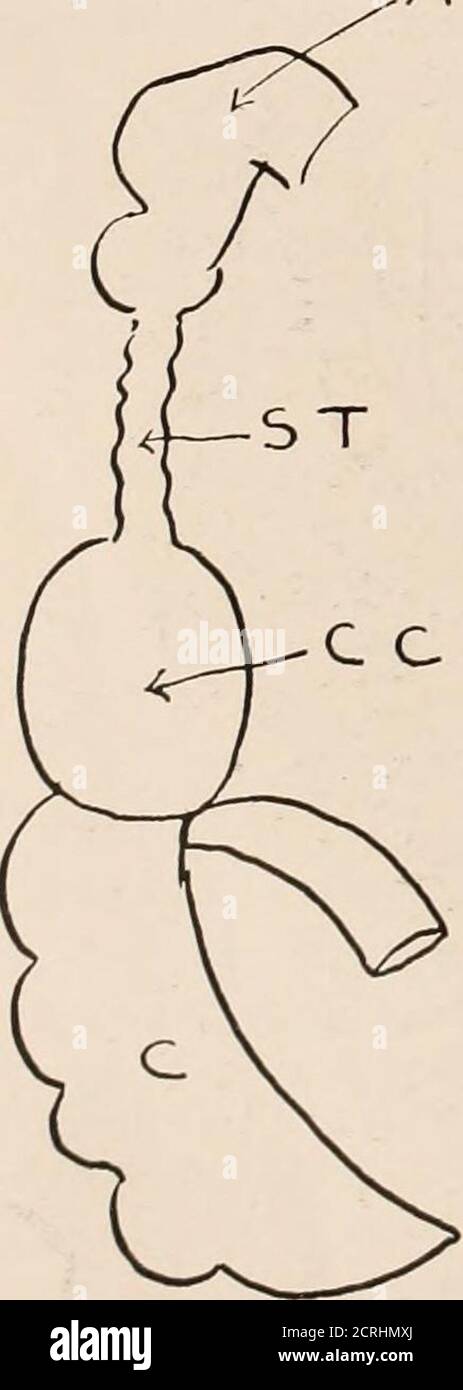 . Journal of radiology . Tig. 5—Proximal colon, hardened insitu (Quains ...