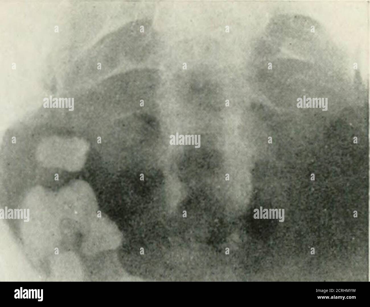 . Radiography, X-ray therapeutics and radium therapy Stock Photo - Alamy