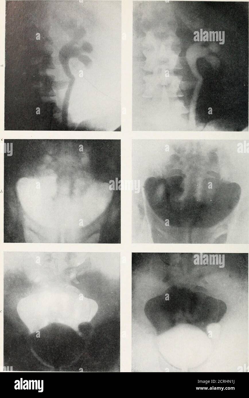 . Radiography, X-ray therapeutics and radium therapy . PLATE LI ...