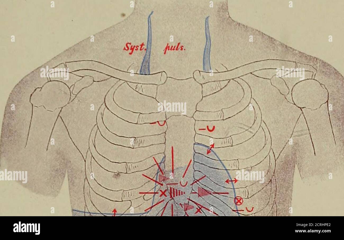 . A practical treatise on medical diagnosis for students and physicians ...