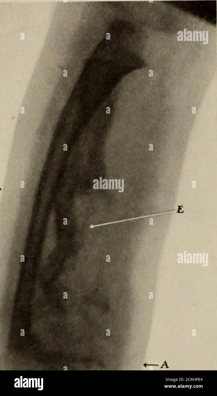 . Living anatomy and pathology Stock Photo - Alamy