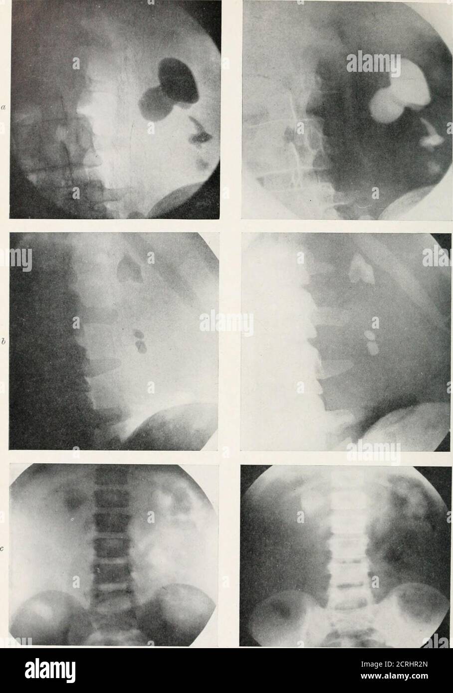 . Radiography, X-ray therapeutics and radium therapy . rt tubes called ...