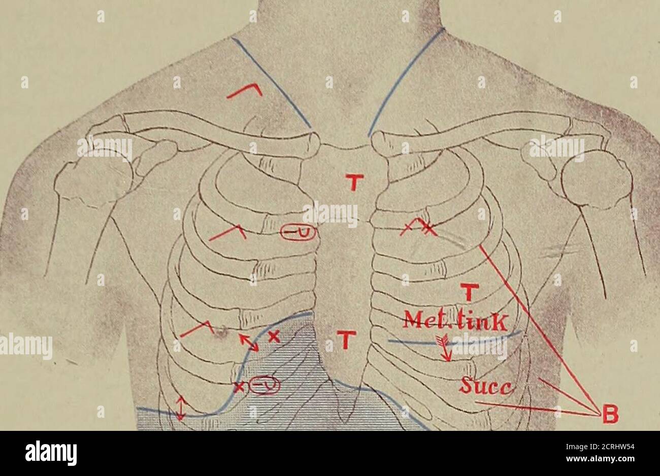 . A practical treatise on medical diagnosis for students and physicians ...
